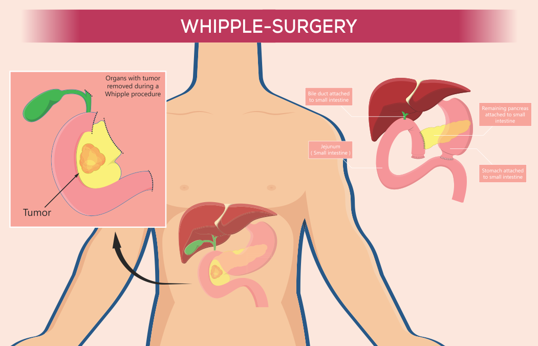 TX Hospitals: Best Multi-Specialty Hospitals in Hyderabad